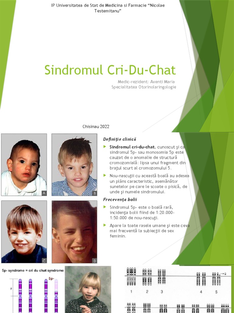 Sindromul Cri Du Chat | PDF