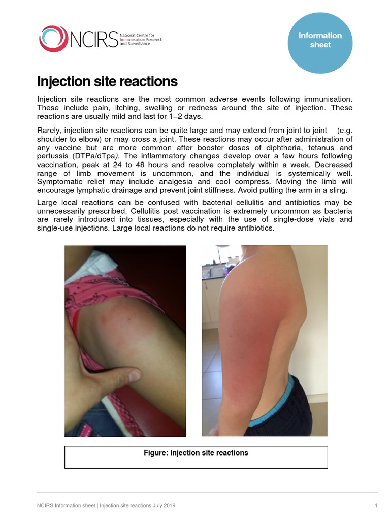 Injection Site Reactions Explained | PDF | Vaccines | Health Care