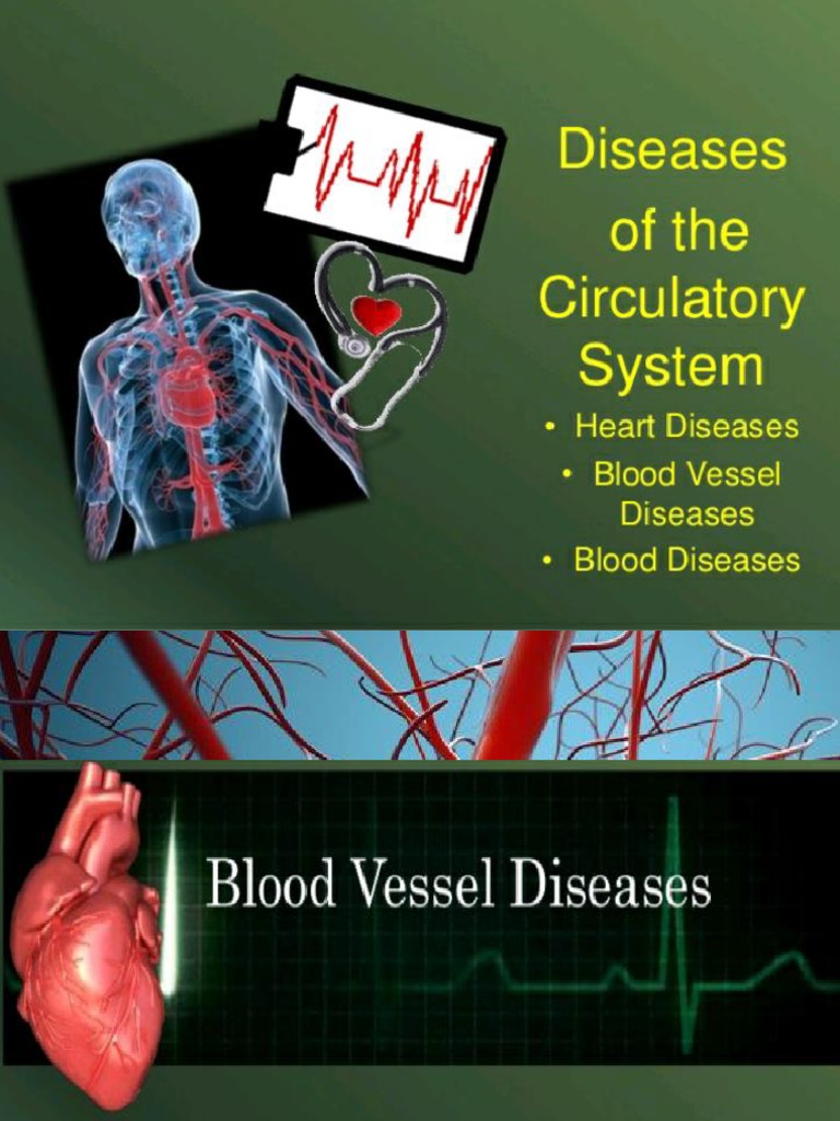 Key Diseases of the Circulatory System | PDF | Coronary Artery Disease ...