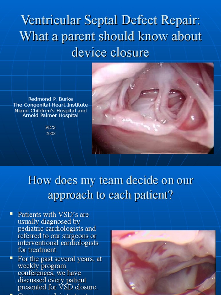 VSD Ventricular Septal Defect Repair | PDF | Cardiology ...