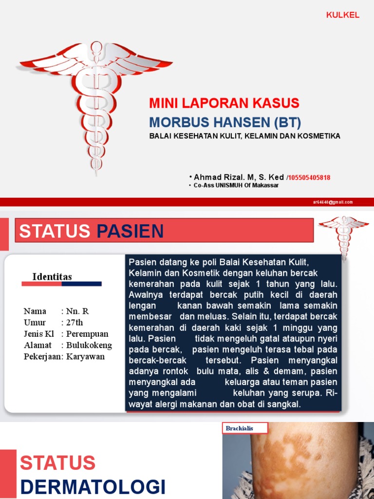 Mini Lapsus 5 Morbus Hansen (BT) | PDF