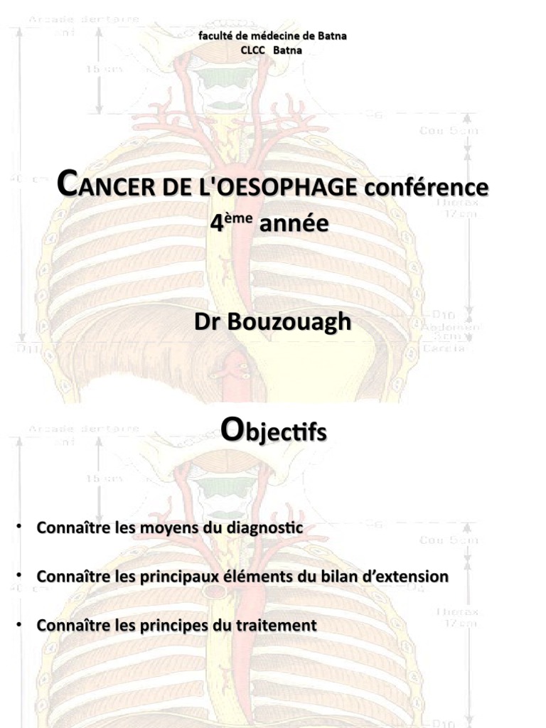 Cancer de l'œsophage : diagnostic et traitement | PDF | Cancer de l ...
