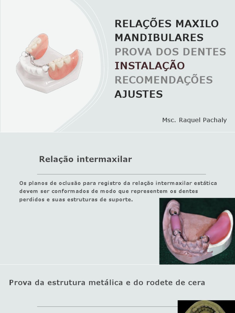 PPR Passo A Passo Da Prova Da Estrutura Metálica A Instalação | PDF ...