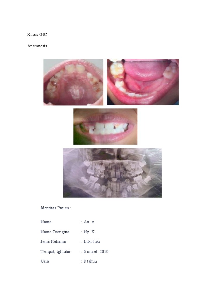 Kasus GIC Anamnesis | PDF | Sains & Matematika