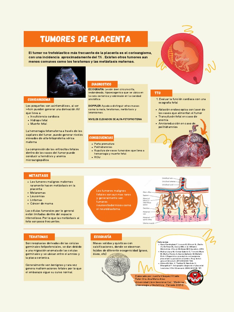 Tumores de Placenta | PDF | Cáncer | Neoplasias