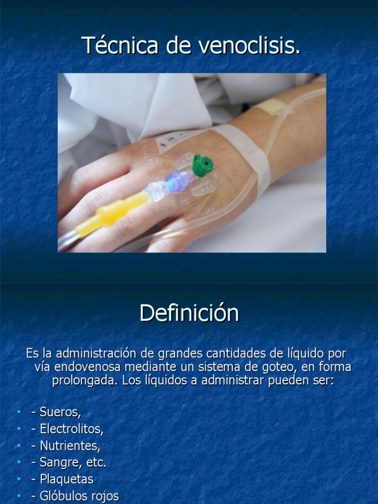 Técnica de venoclisis