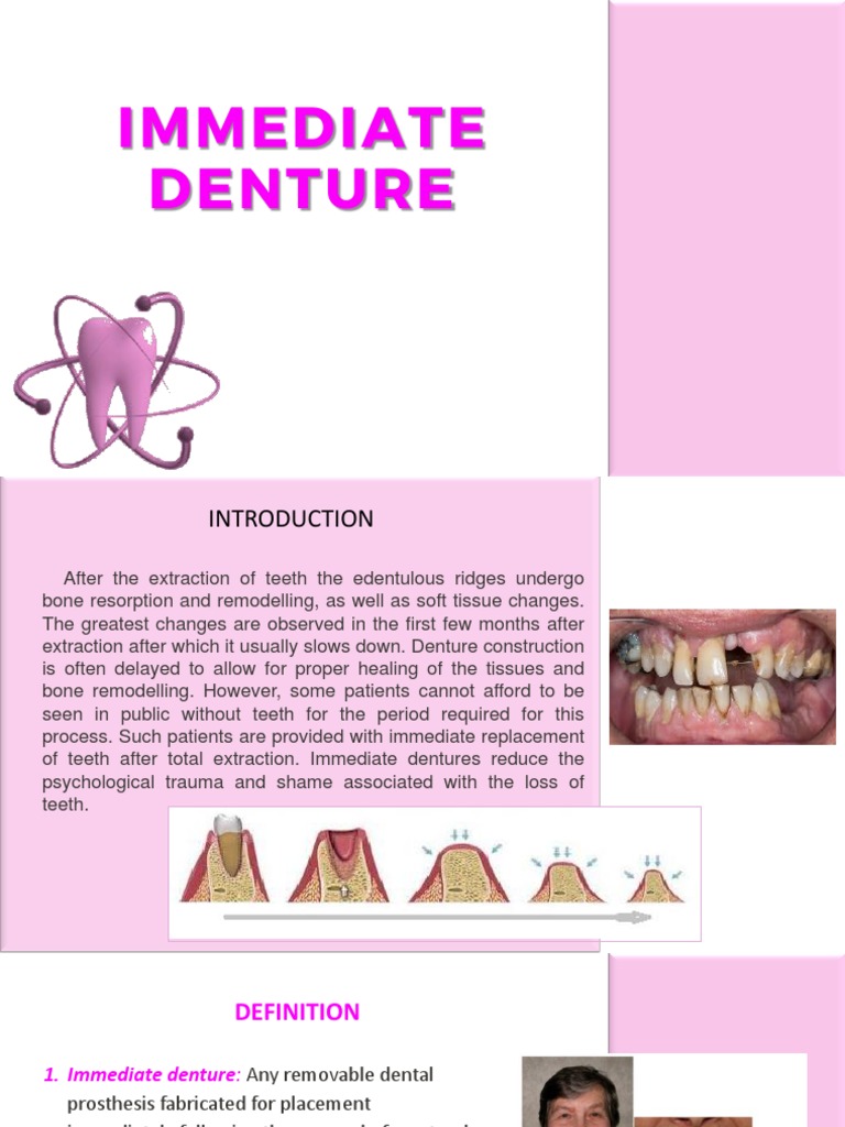 Immediate Dentures: Indications, Contraindications, Advantages and ...