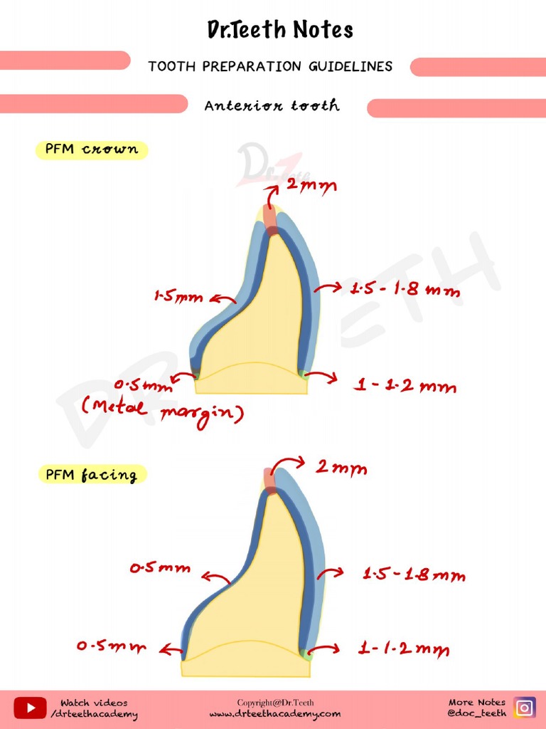 Tooth Preparation FPD | PDF