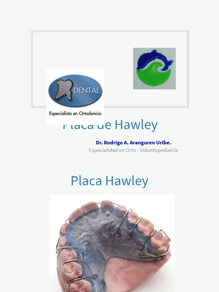 Placa Hawley. | PDF | Ramas de Odontología | Boca