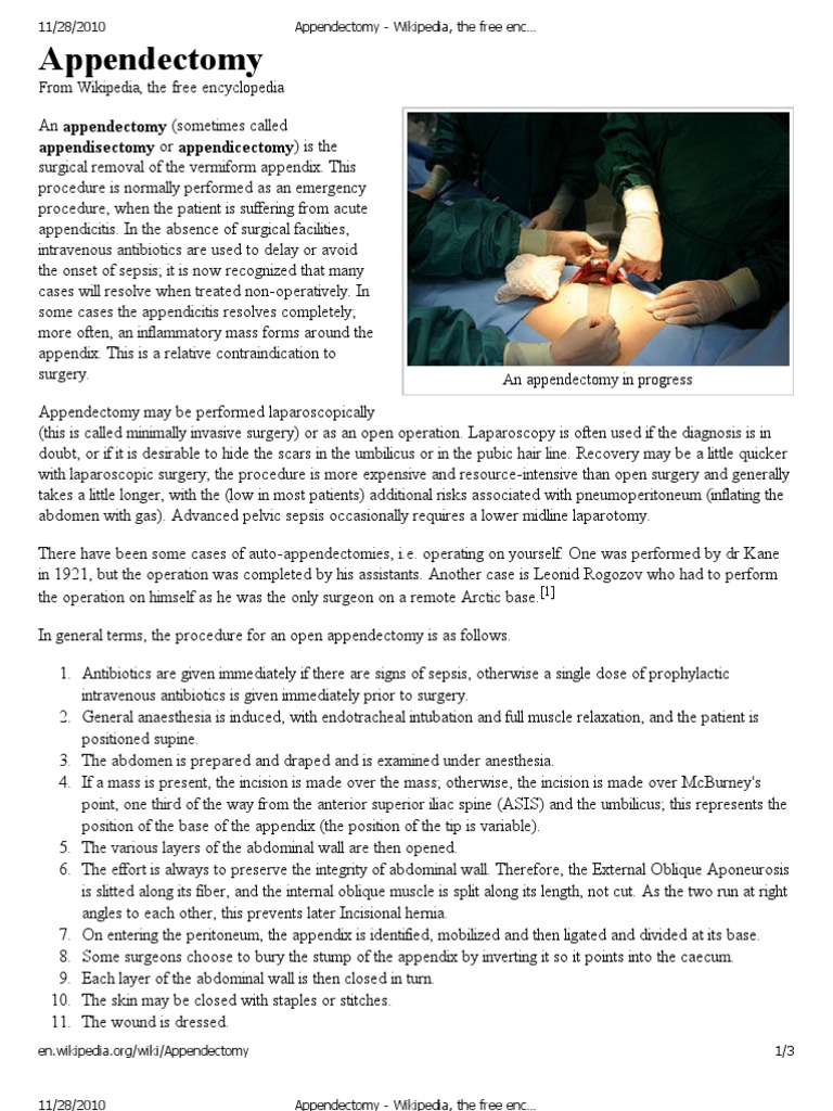 Appendectomy - Wikipedia, The Free Encyclopedia | Surgery | Medicine