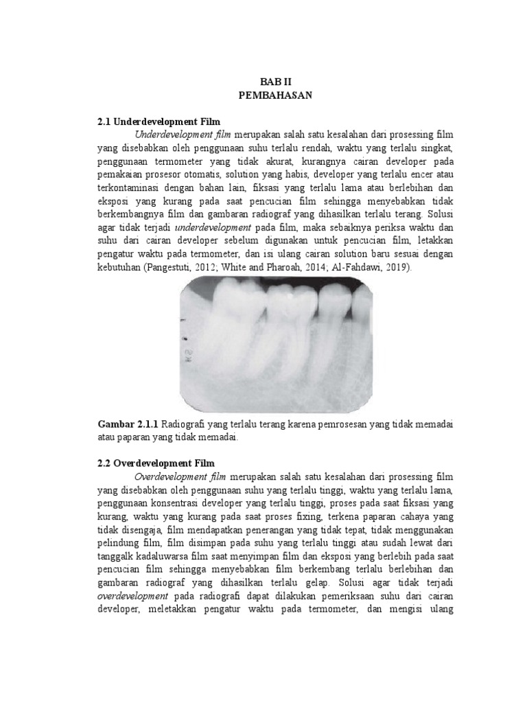 Underdeveloped Film, Overdeveloped Film, Dan Reticulation of Emulsion | PDF