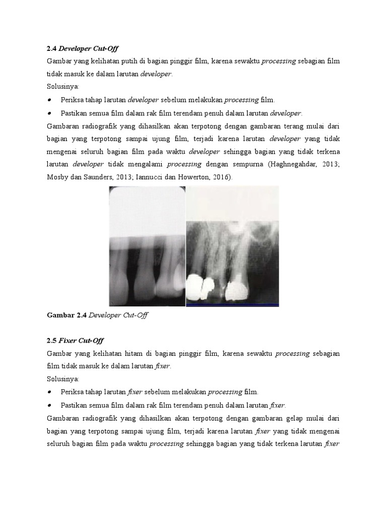 Kesalahan-Kesalahan Radiografi | PDF