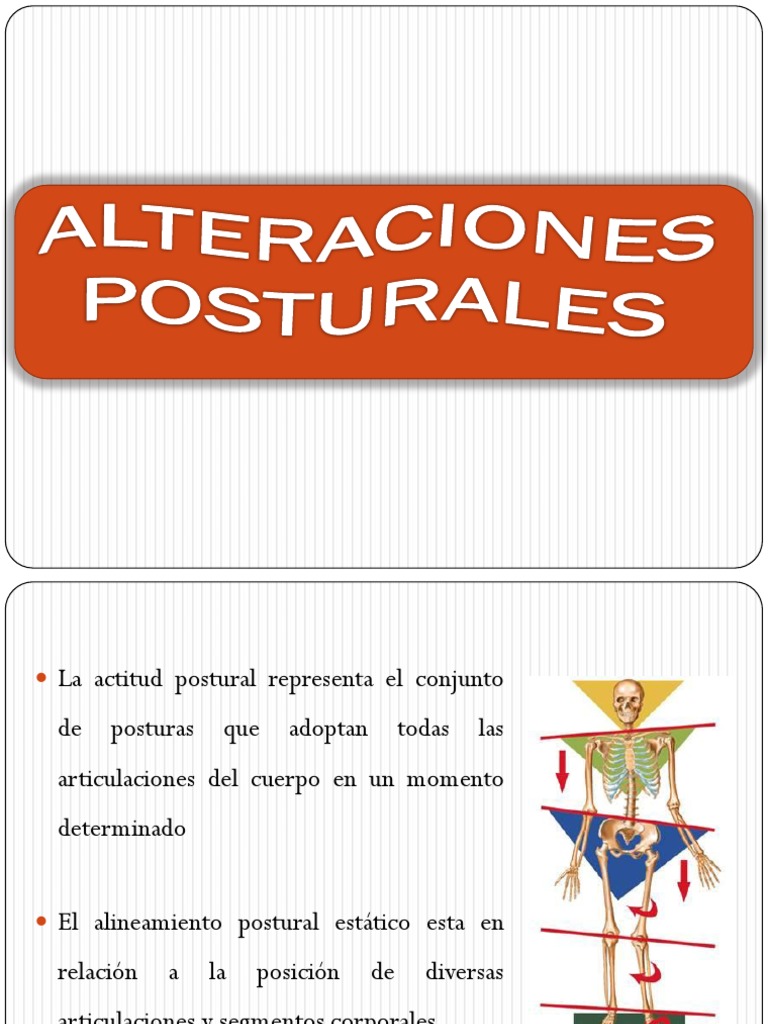 5 Alteraciones Posturales Comunes | PDF | Pie | Rodilla