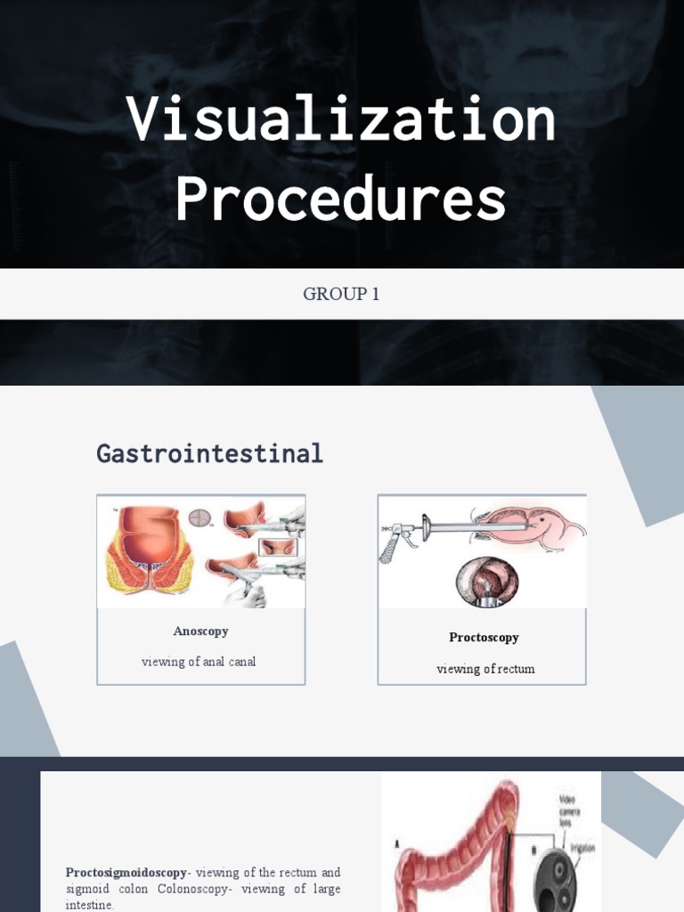 Visualization Procedures | PDF | Angiography | Ct Scan