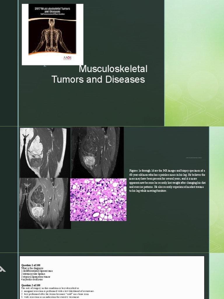 Musculoskeletal Tumors and Diseases | PDF | Sarcoma | Biopsy
