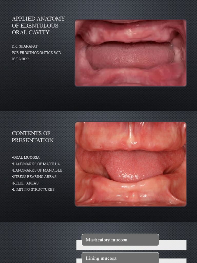 Anatomy of Edentulous Oral Cavity | PDF | Dentistry Branches | Mouth