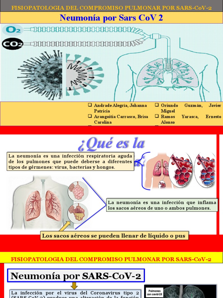 FSPT DE LA Neumonia Por SARS COV 2 | PDF | Neumonía | Inflamación