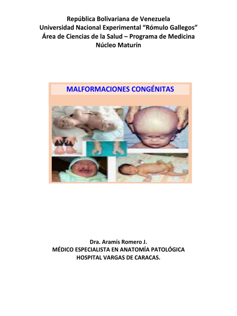 Malformaciones Congenitas | PDF | Enfermedades y trastornos | Especialidades Medicas