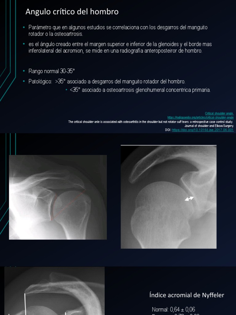 Angulo Critico Del Hombro | PDF