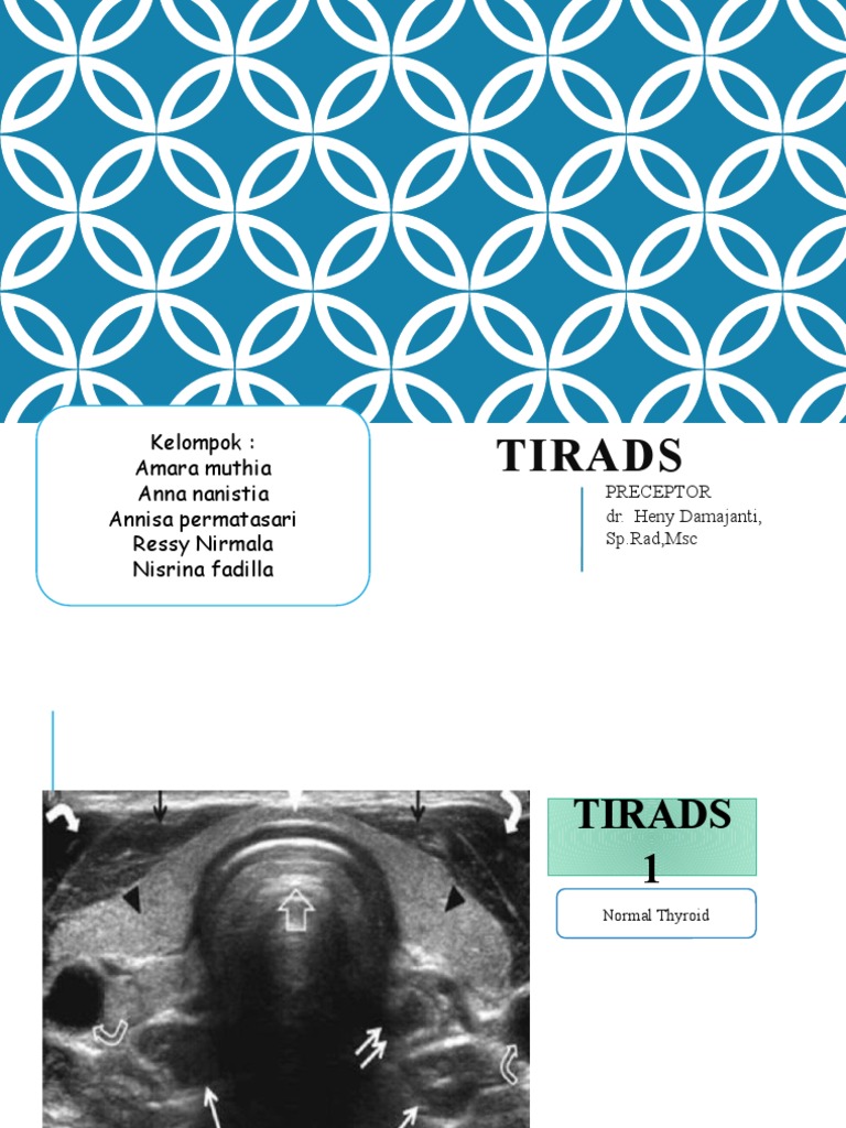 Tirads: Kelompok: Amara Muthia Anna Nanistia Annisa Permatasari Ressy ...