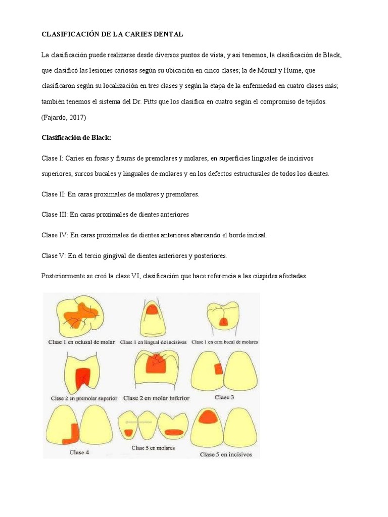 Clasificación de Caries Dental | PDF | Diente | Esmalte de dientes