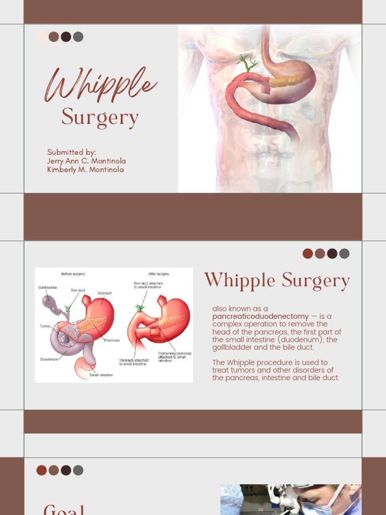 Whipple Surgery | PDF | Surgery | Medical Specialties