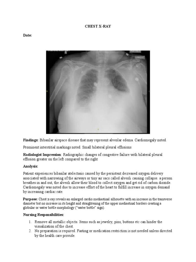 Chest X-Ray and Cardiac Imaging Report | PDF | Heart Valve | Ventricle ...