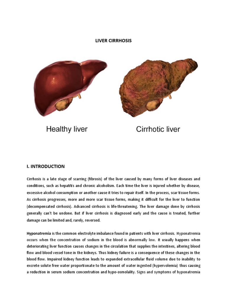 Case Study Liver Cirrhosis | PDF | Cirrhosis | Liver