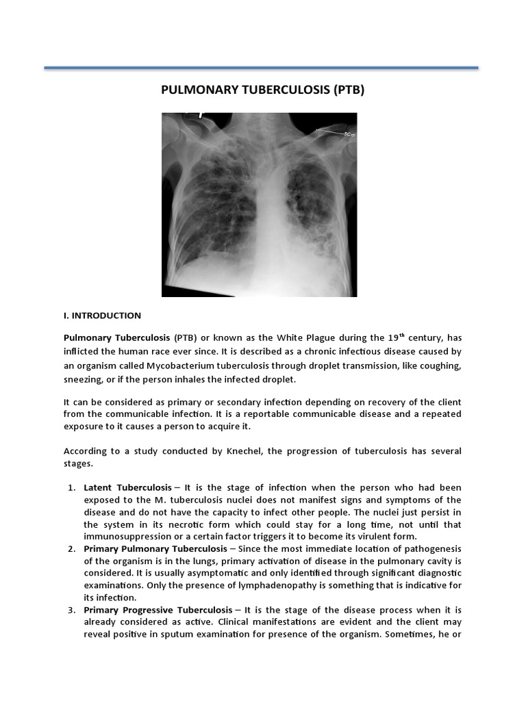 Case Study Pulmonary Tuberculosis | PDF | Tuberculosis | Infection