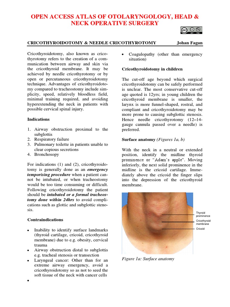 Cricothyroidotomy Techniques and Indications | PDF | Larynx ...