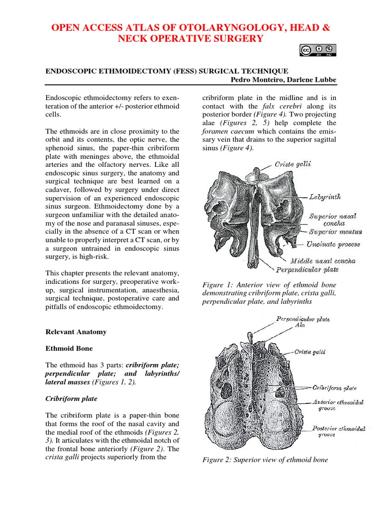 Endoscopic Ethmoidectomy - FESS - Surgical Technique | PDF | Human Nose ...