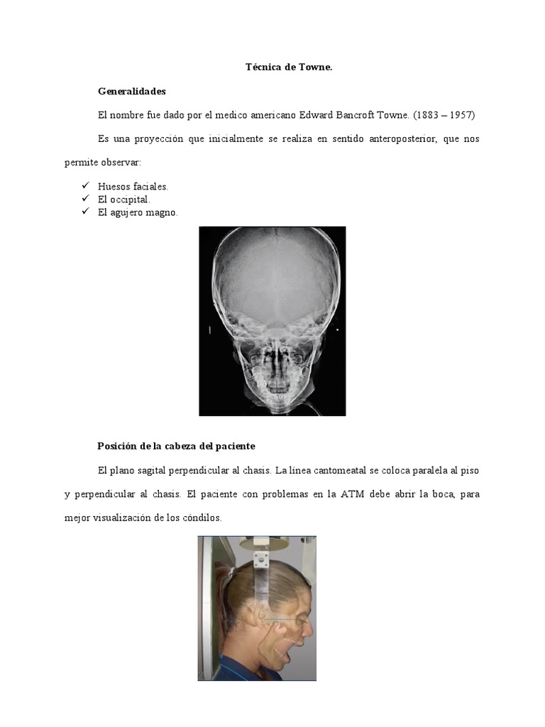 Tecnica Posteroanterior de Waters | PDF | Cráneo | Cara