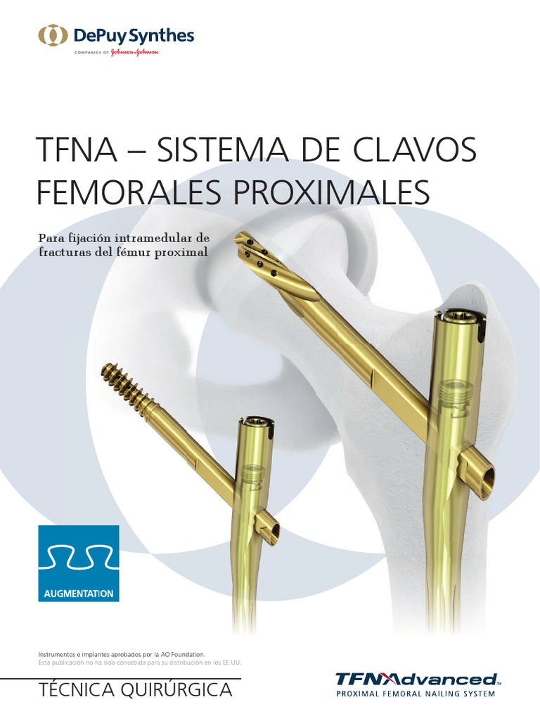 Clavo Tfna | PDF | Tornillo