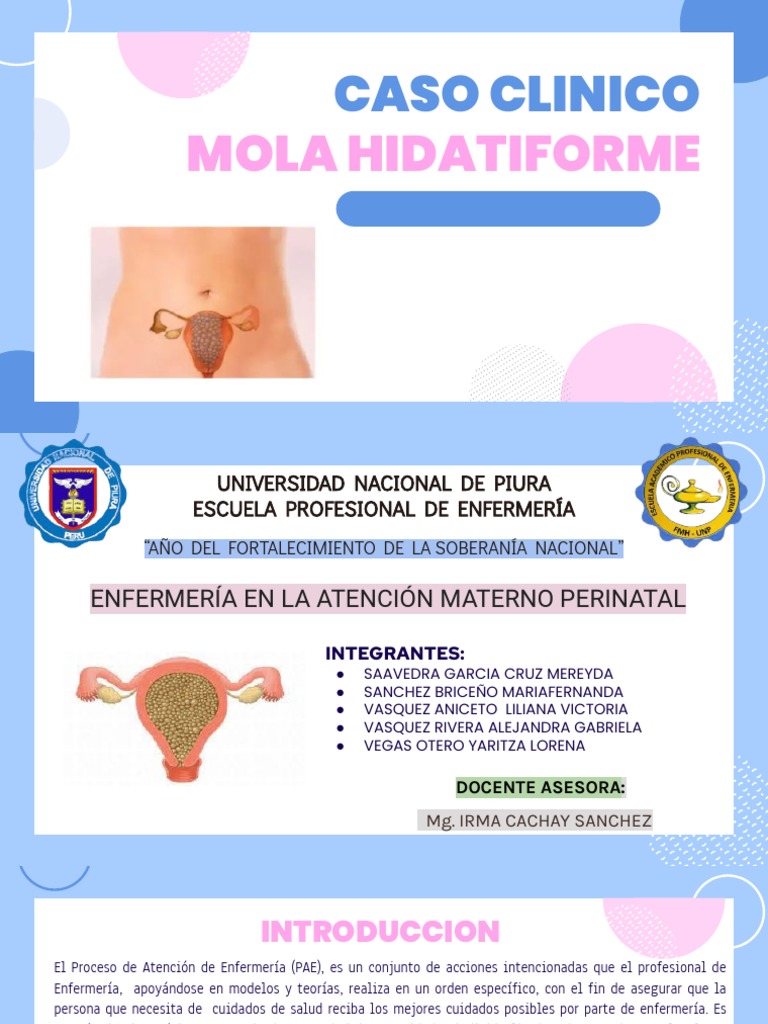 Proceso de Atencion de Enfermeria - Mola Hidatiforme | PDF | El ...