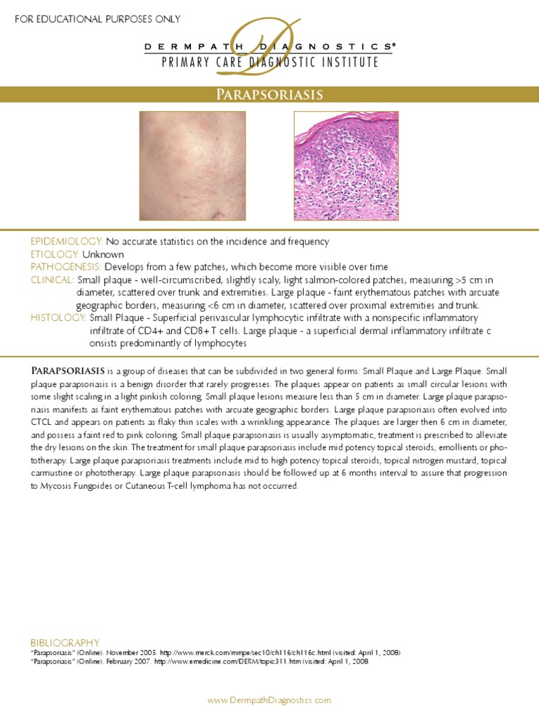 Parapsoriasis: Primary Care Diagnostic Institute | PDF | Cutaneous ...