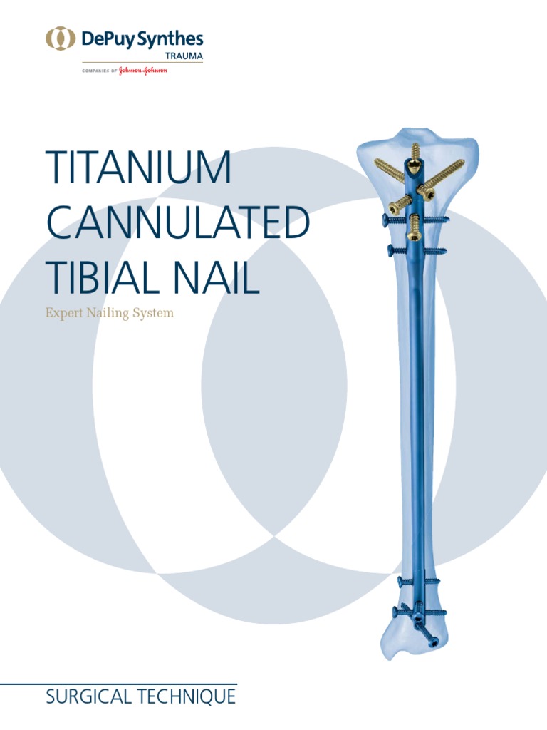 Titanium Cannulated Tibial Nail: Surgical Technique | PDF | Screw | Drill