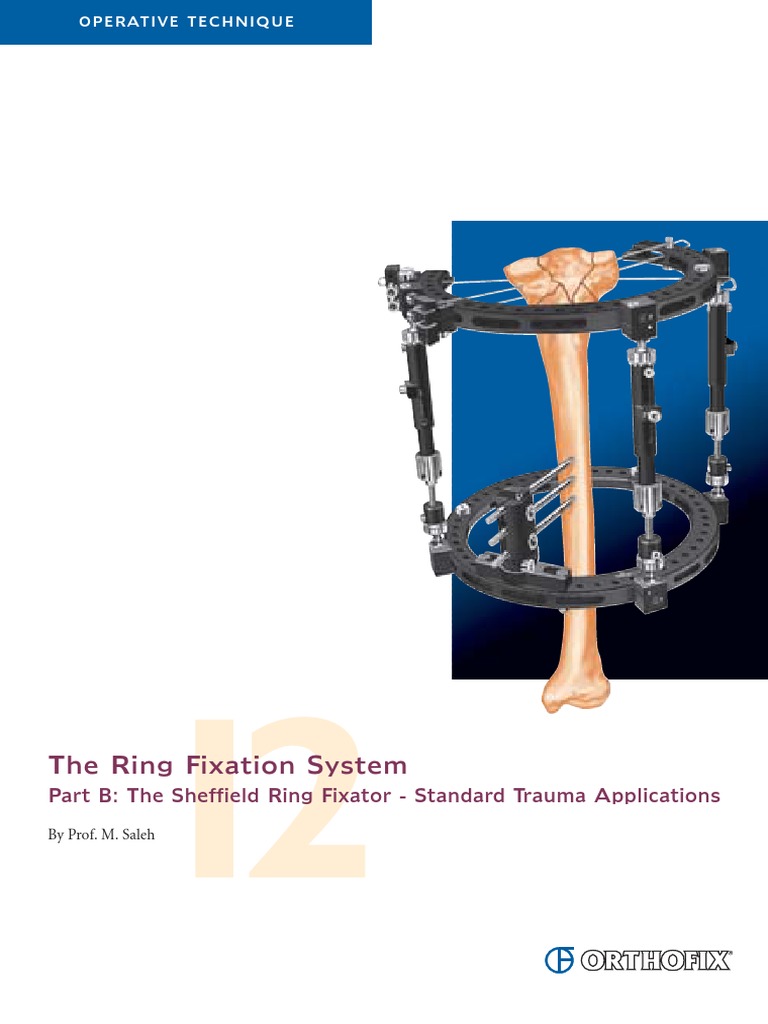 Orthofix Hybrid Ring Trauma Applications | PDF