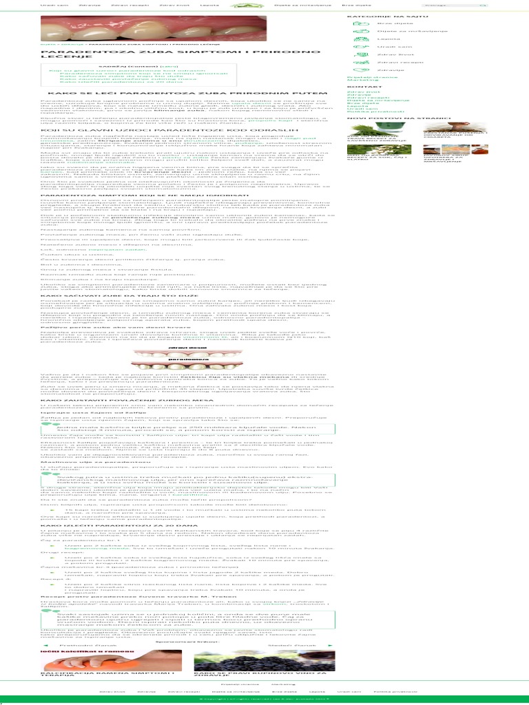 Kako Se Leči Paradentoza Zuba - Simptomi - Uzrok - Slike | PDF