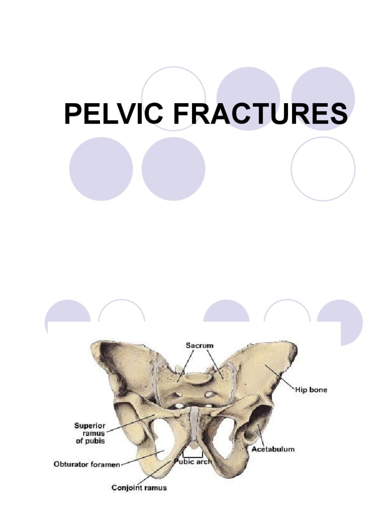 Fracture Pelvis, Hip Dislocations | PDF | Pelvis | Hip