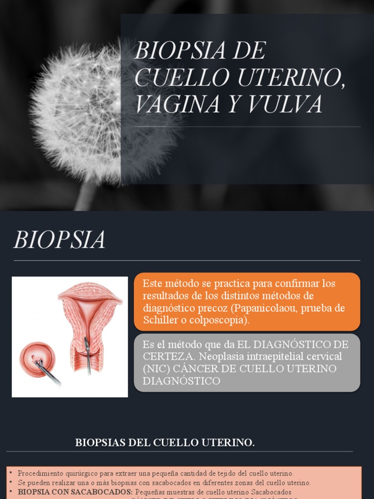 Biopsia de Cuello Uterino y Vulva | PDF | Biopsia | Cáncer de cuello ...