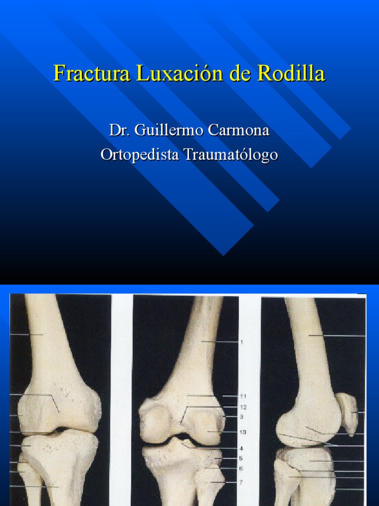 FX - Luxacion - Rodilla - 241007 | PDF | Rodilla | Sistema ...