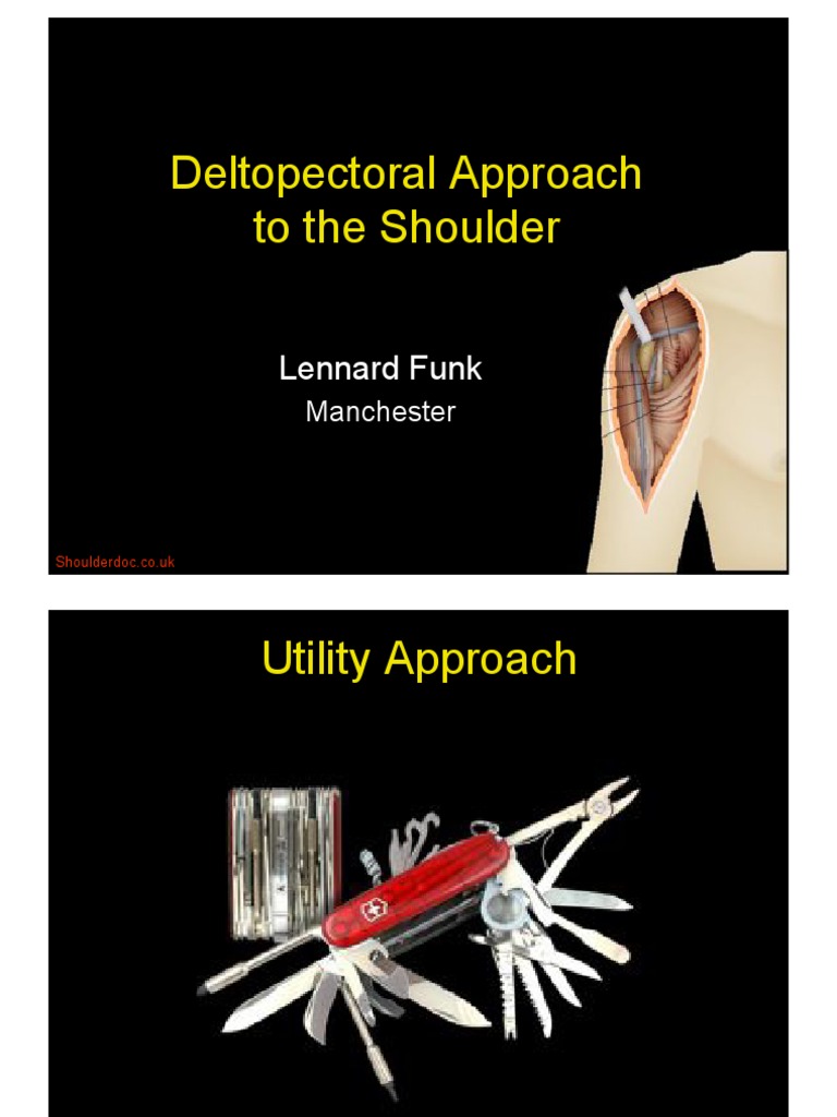 The Deltopectoral Approach: An In-Depth Guide to this Useful Surgical ...