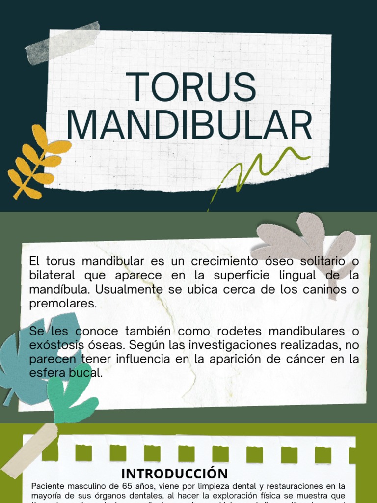 Torus Mandibular | PDF | Odontología | Medicina CLINICA