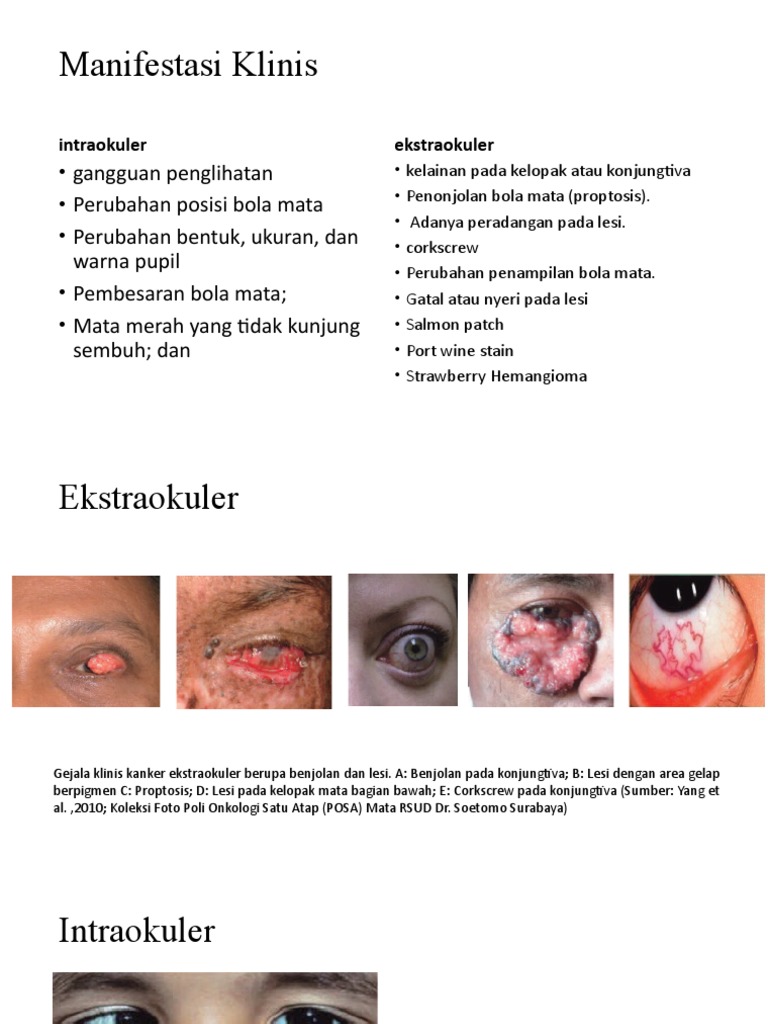 Manifestasi Klinis | PDF