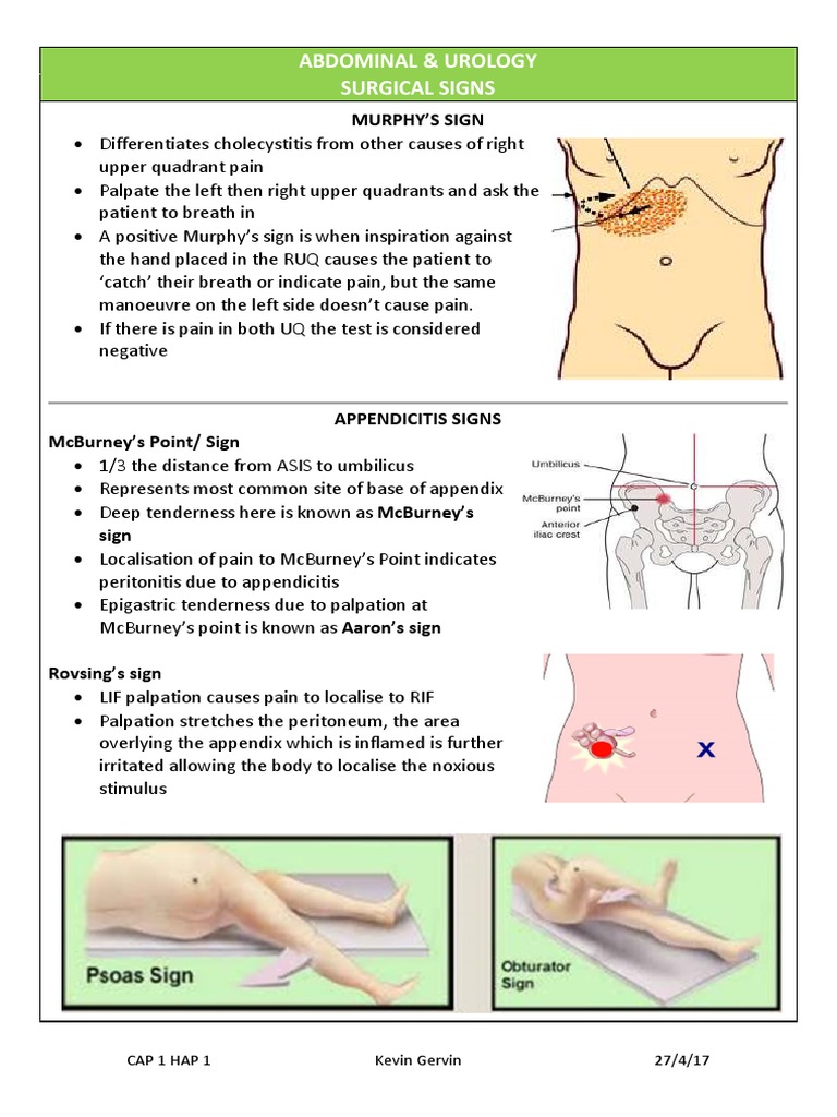 Abdominal & Urology Surgical Signs: Murphy'S Sign | PDF | Abdomen ...