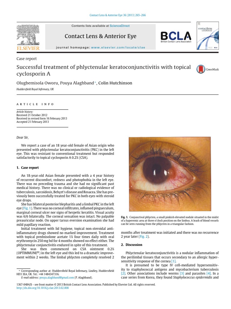 Jurnal - INF - Successful Treatment of Phlyctenular Keratoconjunctivitis With Topical - HV ...