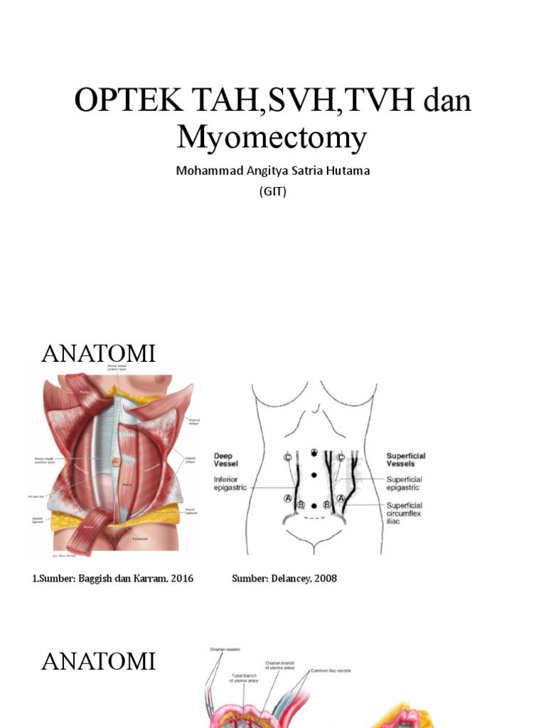TAH SVH TVH Myomectomy Git | PDF