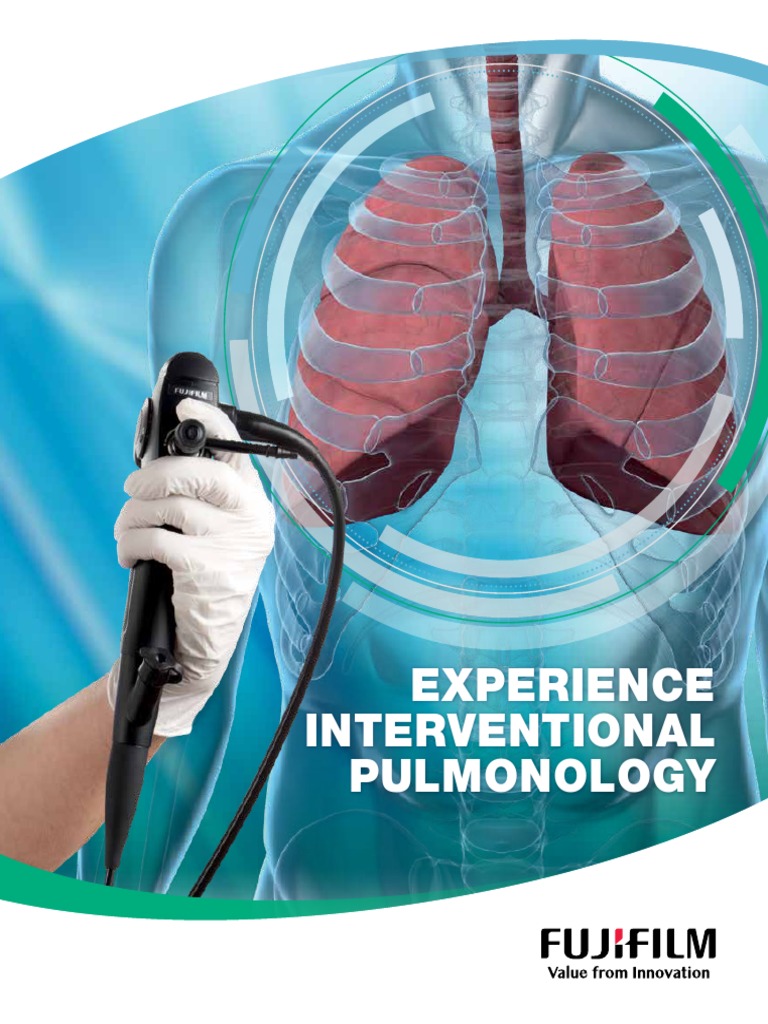 Bronchoscopy Brochure | PDF | Medical Ultrasound | Medical Imaging