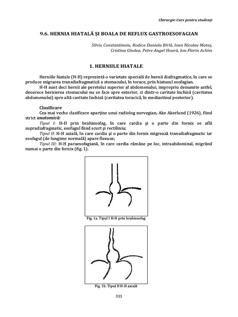 Hernia Hiatala | PDF