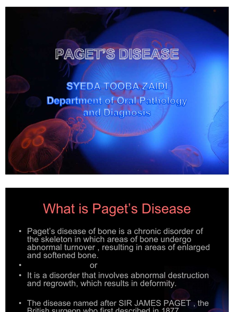 Paget Disease of Bone | PDF | Bone | Skeletal System